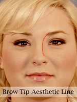 Nasal Analysis Rhinoplasty San Diego La Jolla CA | Dr. Hilinski