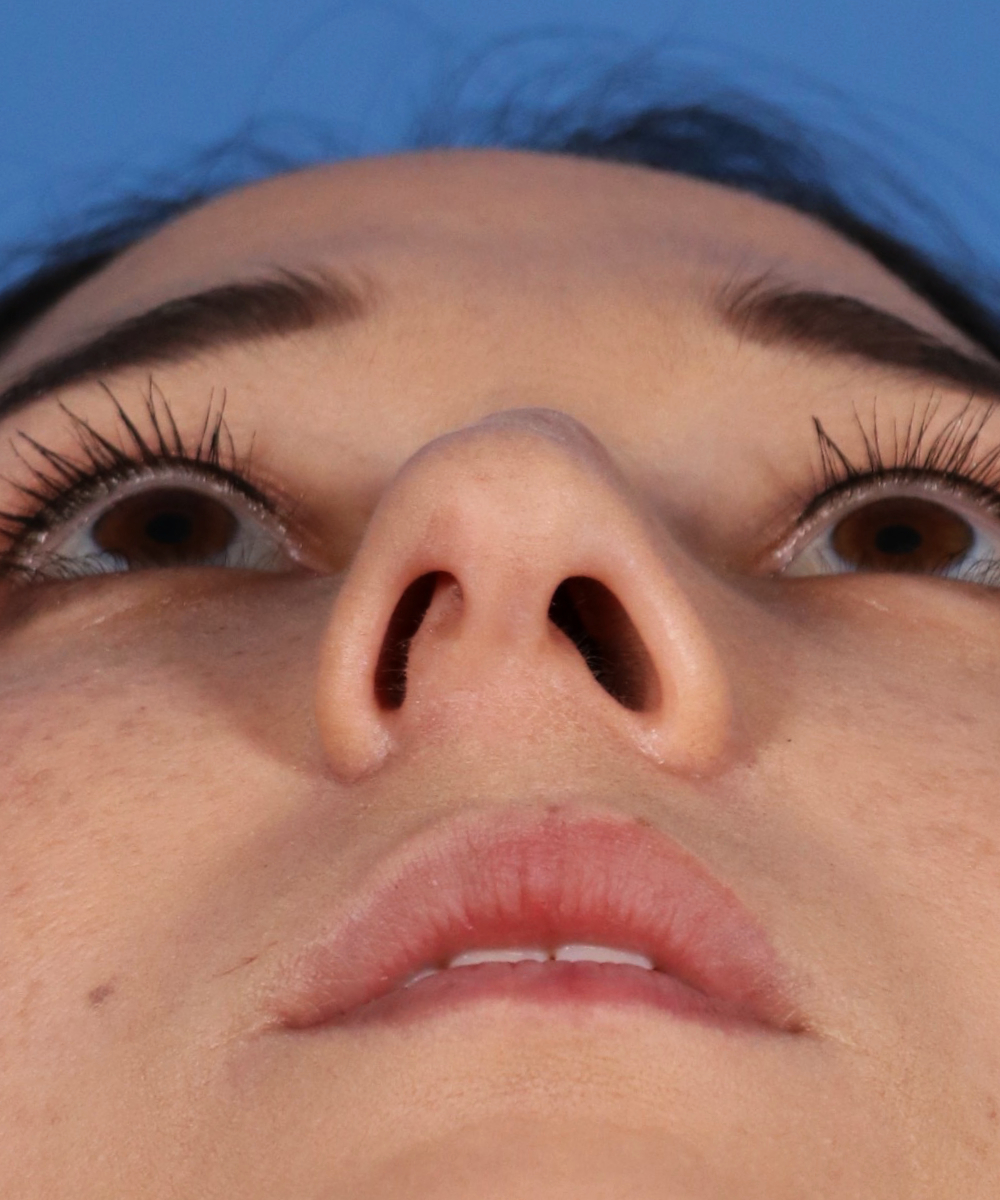 Complete Overhaul | Dr. Hilinski