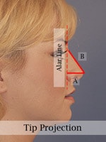 Nasal Analysis Rhinoplasty San Diego La Jolla CA | Dr. Hilinski