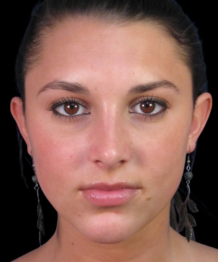 Facial Plastic Surgery San Diego, CA | John Hilinski MD