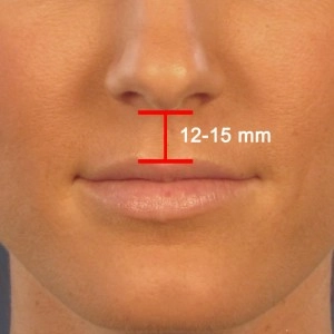 Upper Lip Lift Shortening San Diego CA