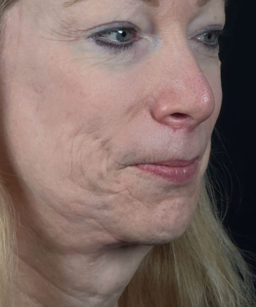 Gallery Archive | John Hilinski, M.D.