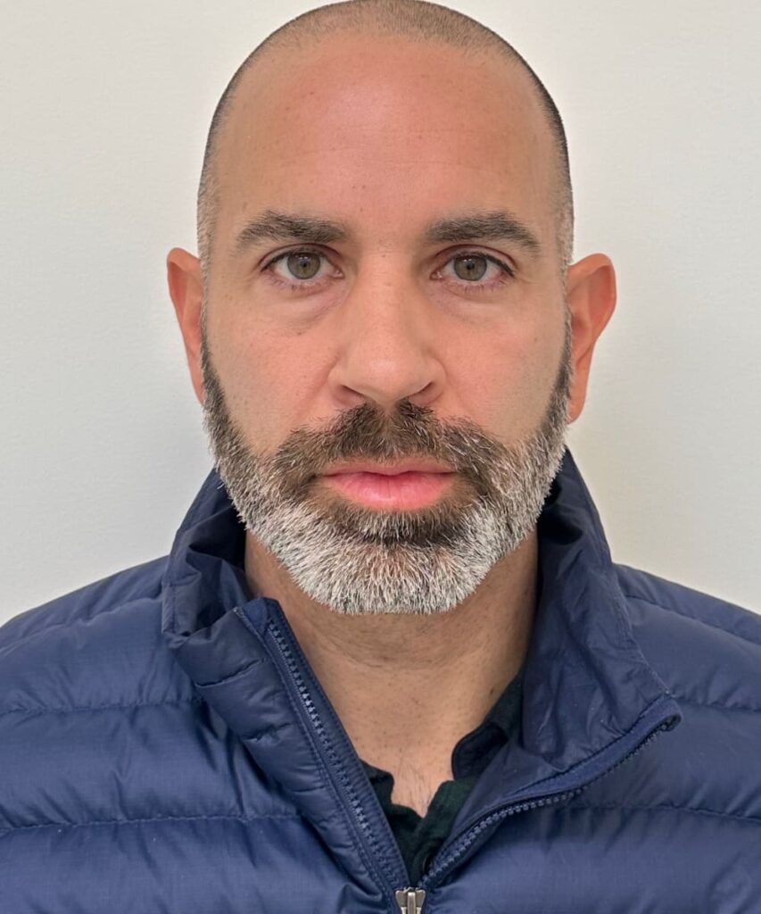 Otoplasty Archives | John Hilinski, M.D.