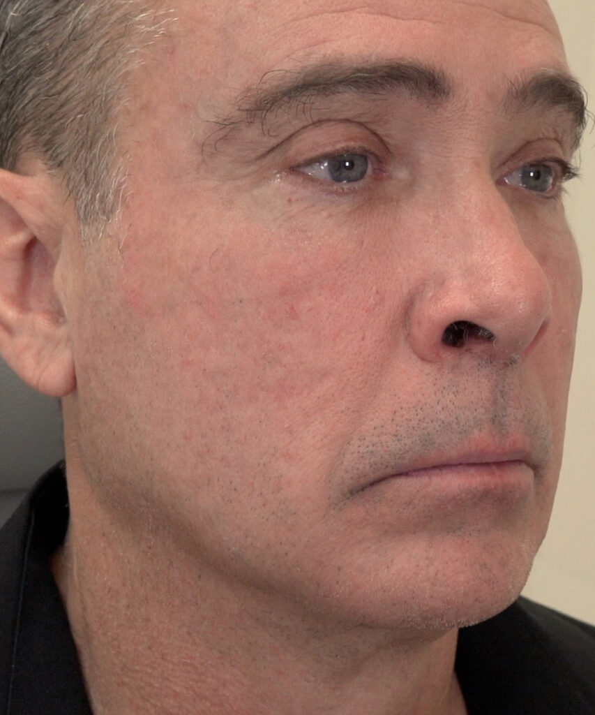 Gallery Archive | John Hilinski, M.D.